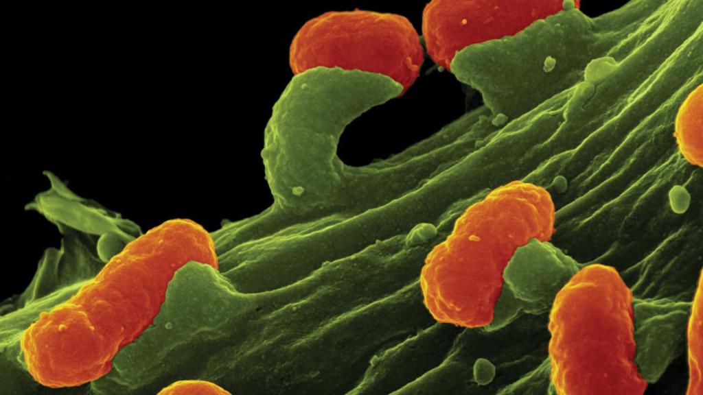 Shiga: una toxina mortífera para propalar el infundio del asesinato de Maza