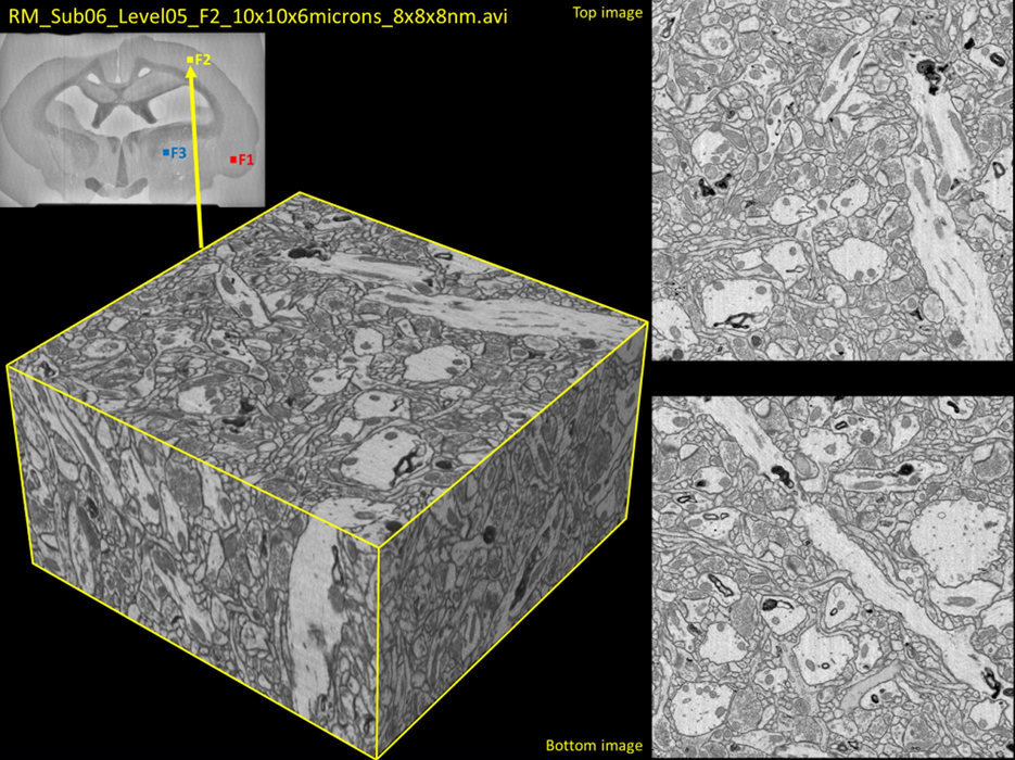 Esta startup promete hacer una copia digital de tu cerebro que durará ...