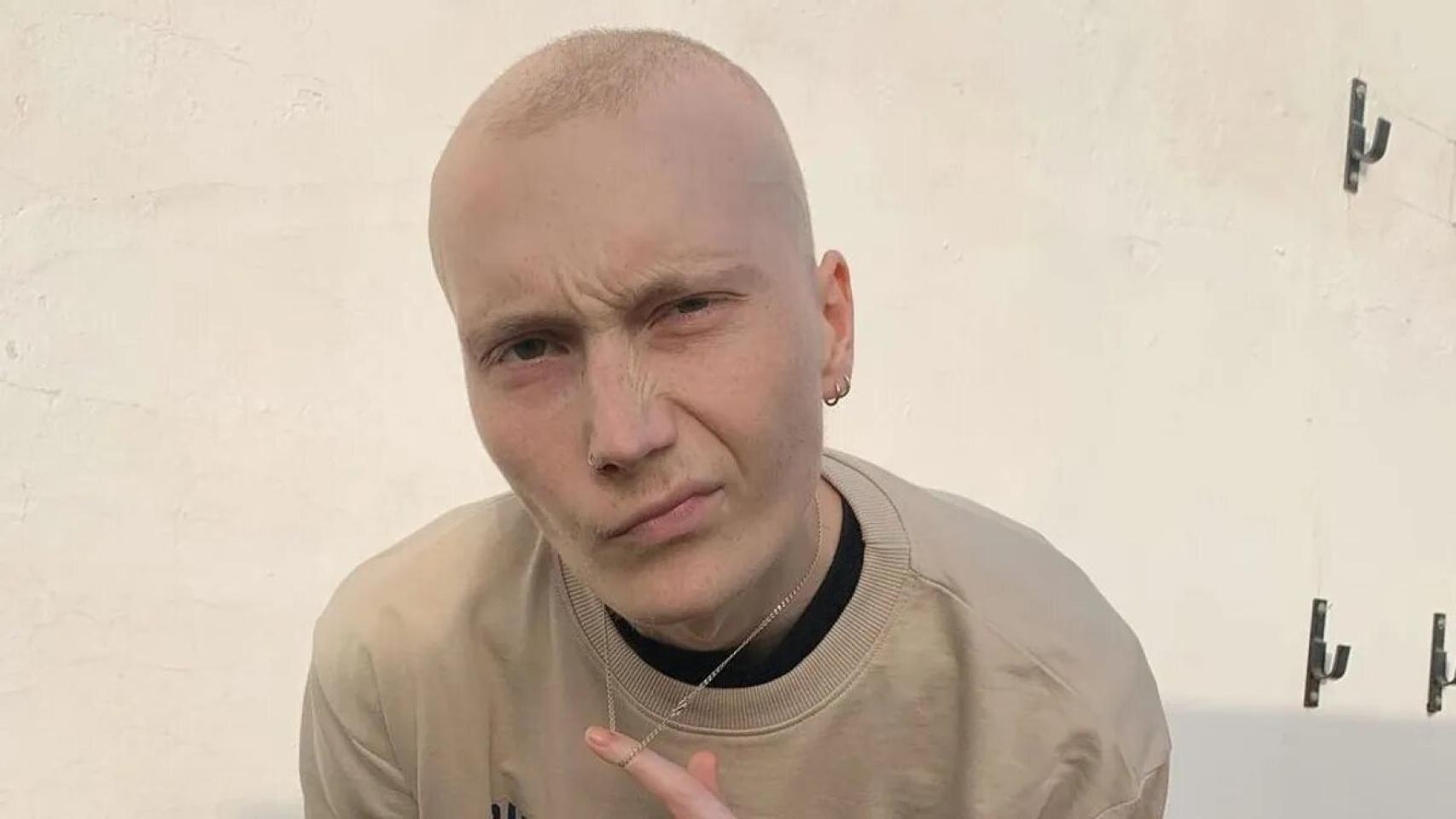 Así es el cáncer que sufría Charlie, el influencer de 20 años: de mal ...