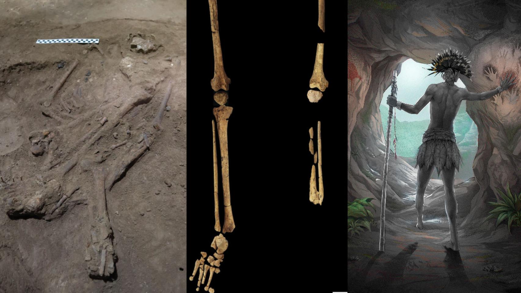 Identifican la operación más antigua de la historia: el pie amputado de ...