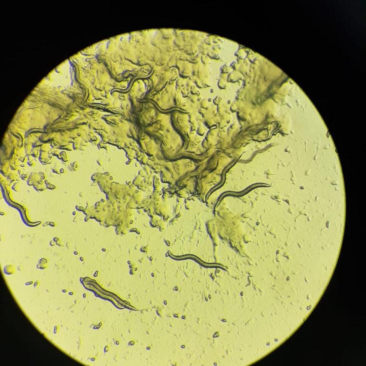 El milagro de Ramón Risco, el investigador que ya resucita gusanos ...