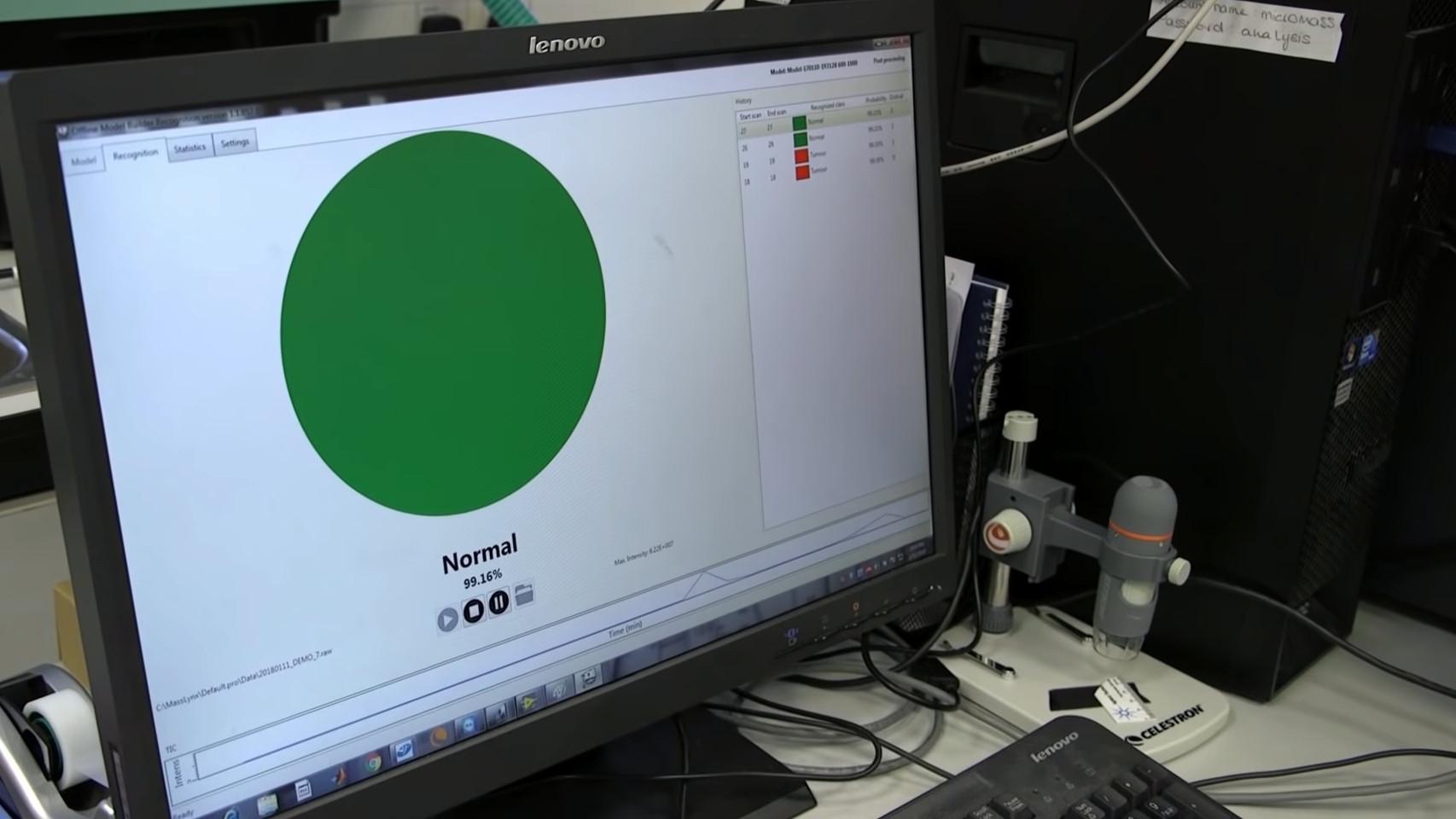 iKnife, el bisturí inteligente que 'huele' los tumores: puede detectar ...