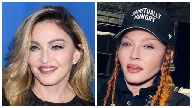 Madonna admite sus últimas operaciones estéticas: los retoques que se ...