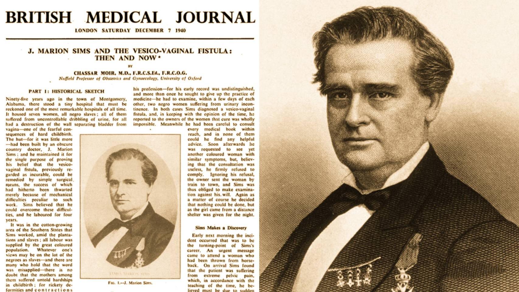 J. Marion Sims y los terribles experimentos que dieron luz a la ...