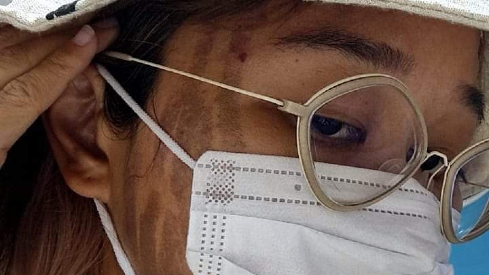 El desgarrador aspecto de una presentadora: un tratamiento solar le ...